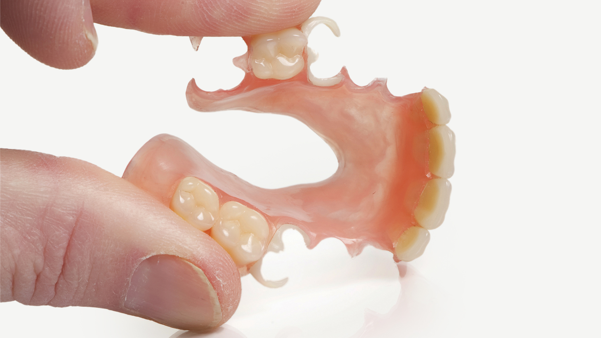 FlitZ® Prothese 'Crafted by Carbon' - Excent Tandtechniek