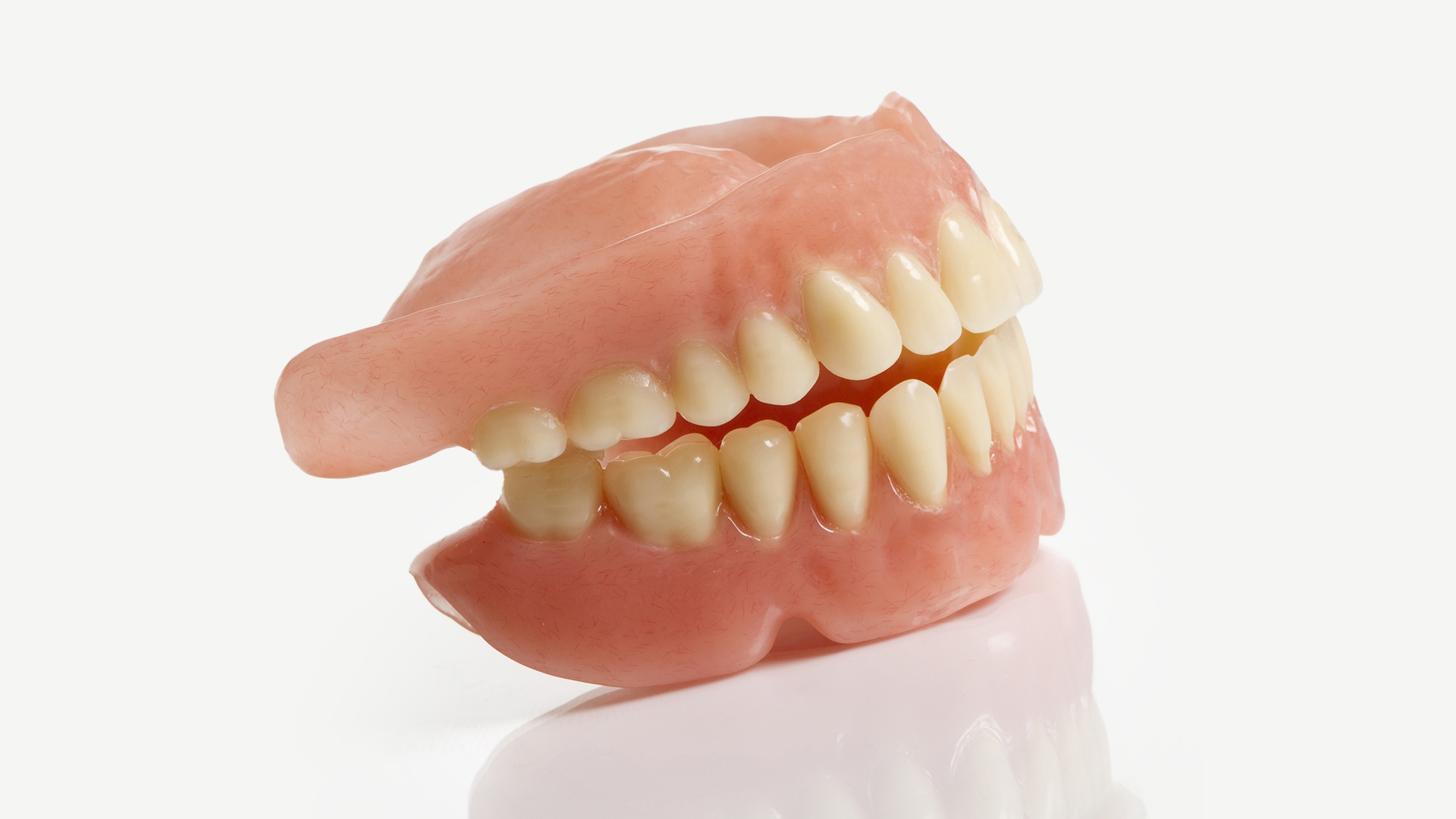 Epithese - Excent Tandtechniek