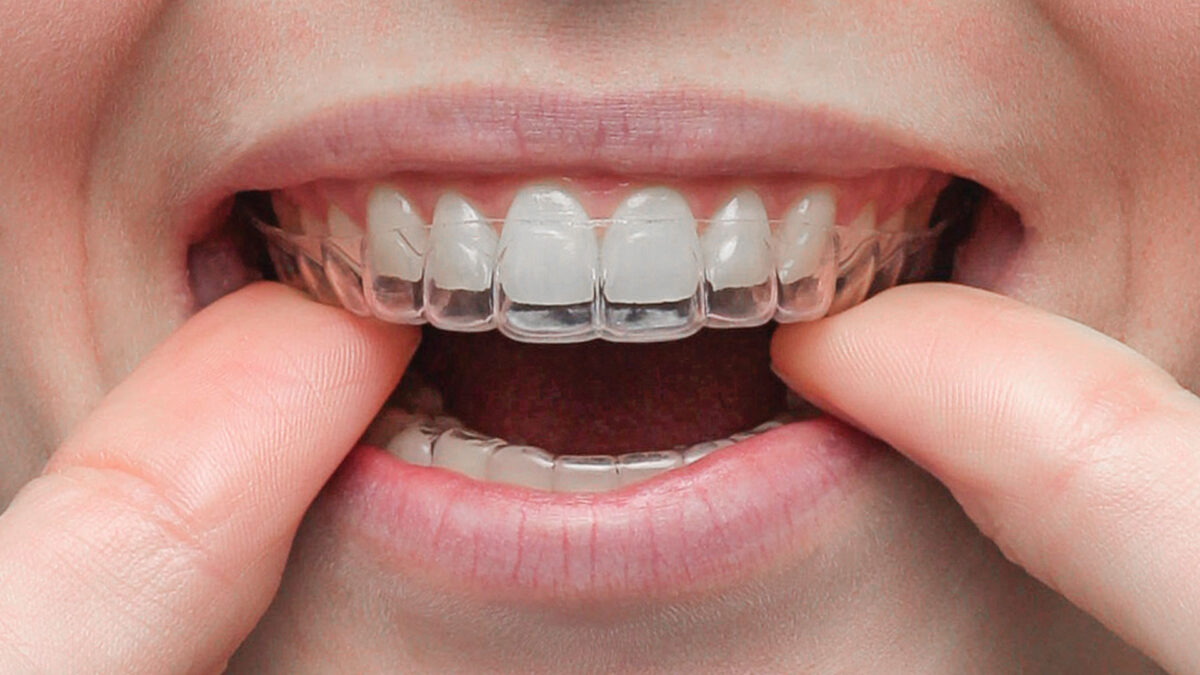 Producten - Excent Tandtechniek