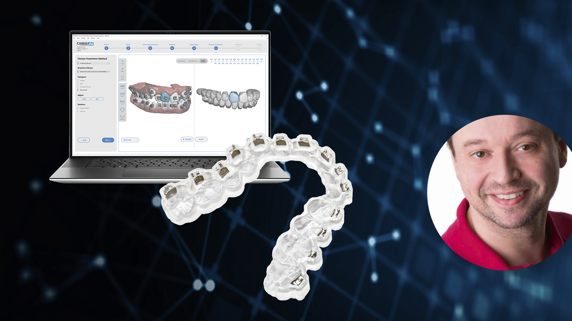 Certificeringscursus: DIBS AI - Excent Tandtechniek